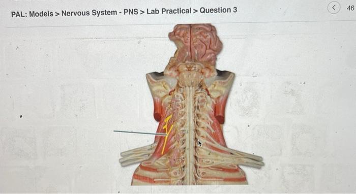 Solved PAL: Models > Nervous System - PNS > Lab Practical > | Chegg.com