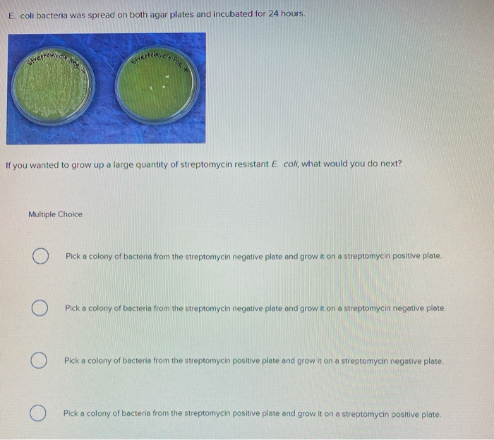 Solved E. coli bacteria was spread on both agar plates and | Chegg.com