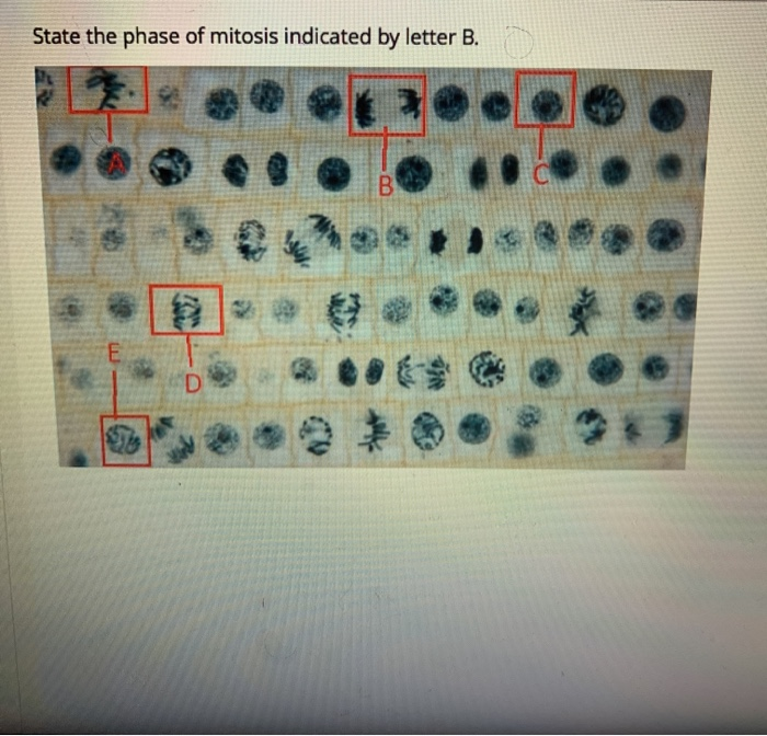 Solved State the phase of mitosis indicated by letter B. O B | Chegg.com