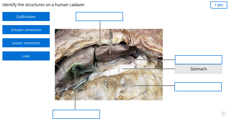 Solved 1.) ﻿Identify the structures on a human cadaver.2.) | Chegg.com