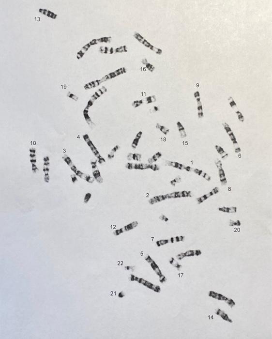 match the karyotype. each one should have a | Chegg.com