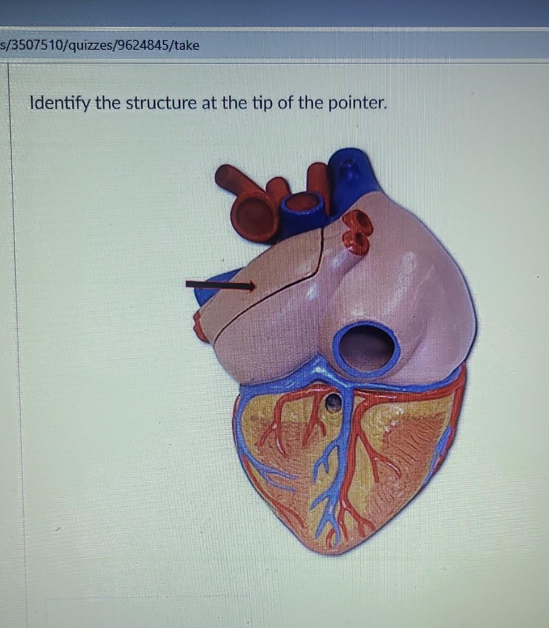 Solved Identify the structure at the tip of the pointer. | Chegg.com