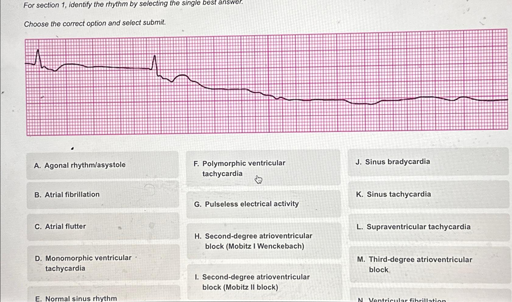Solved For section 1, ﻿identify the rhythm by selecting the | Chegg.com