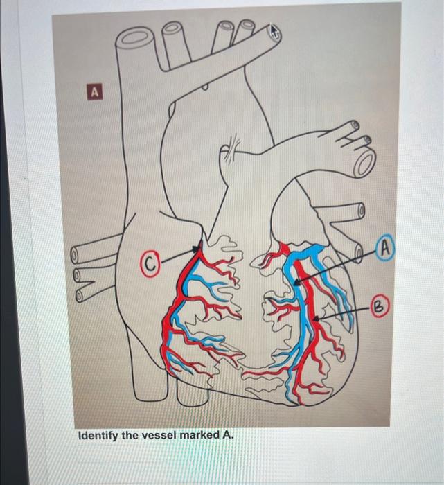 Solved Identify the vessel marked A. | Chegg.com