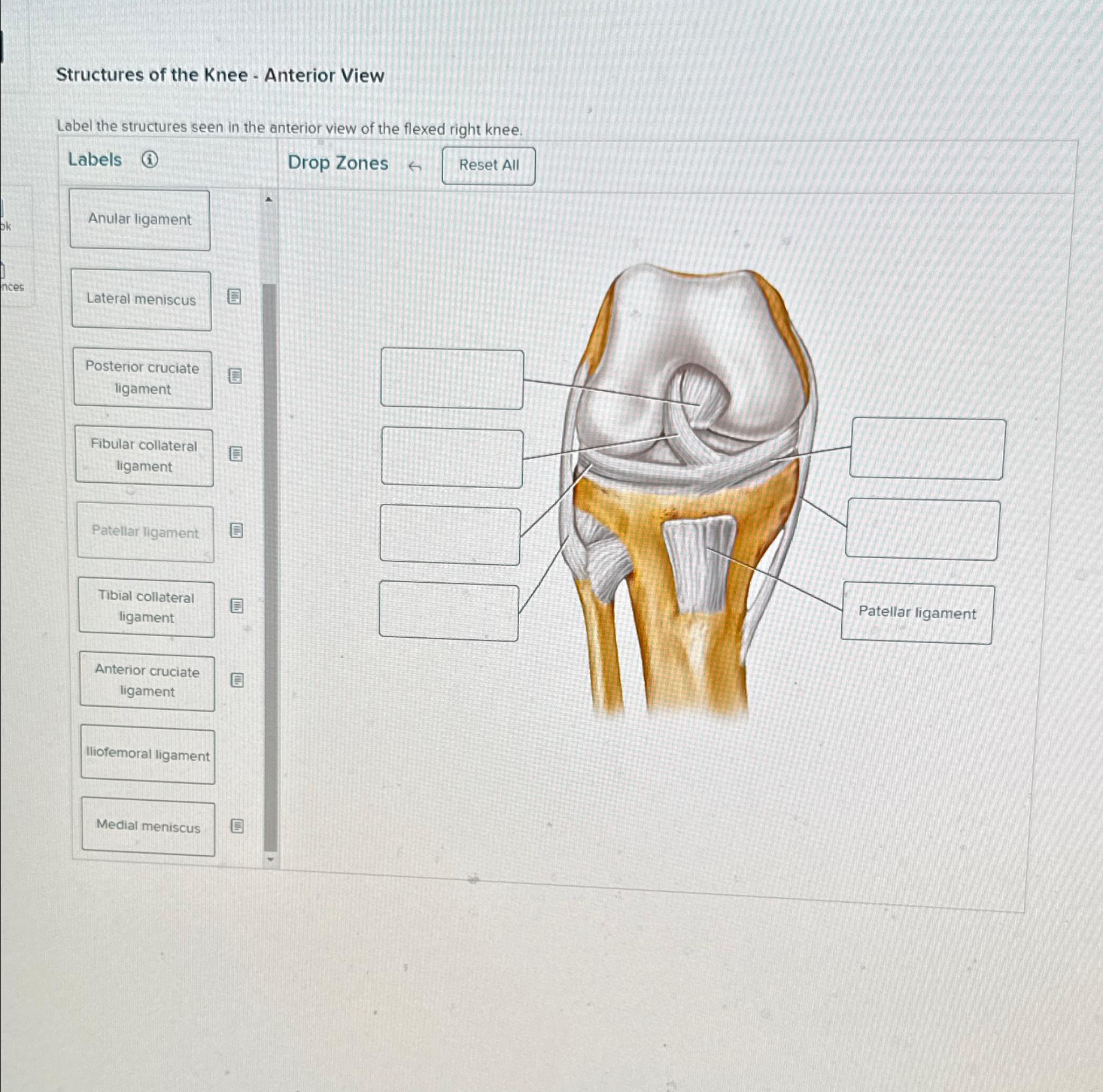 Solved Structures of the Knee - ﻿Anterior ViewLabel the | Chegg.com