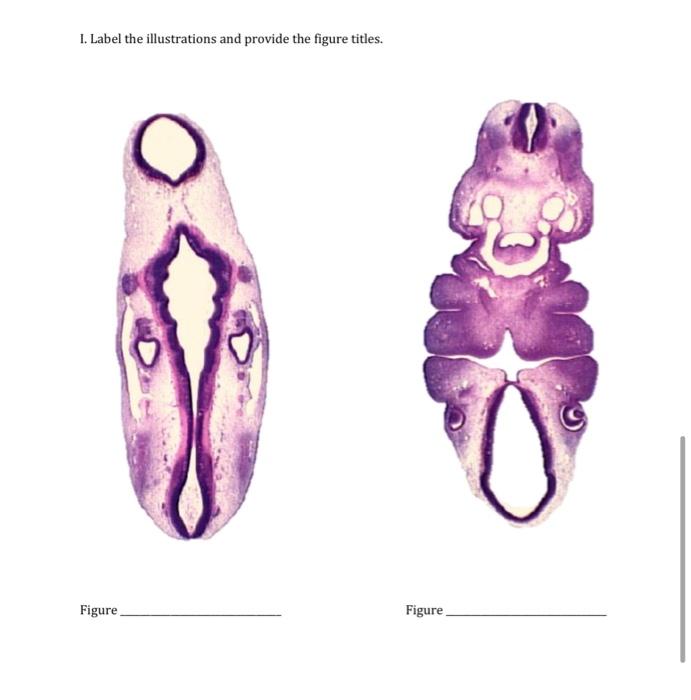 1. Label the illustrations and provide the figure | Chegg.com