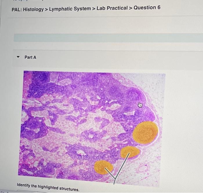 Solved PAL: Histology > Lymphatic System > Lab Practical > | Chegg.com