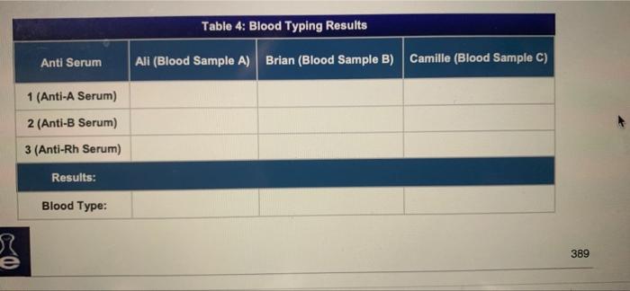Solved Blood typing experiment:I have completed putting the | Chegg.com