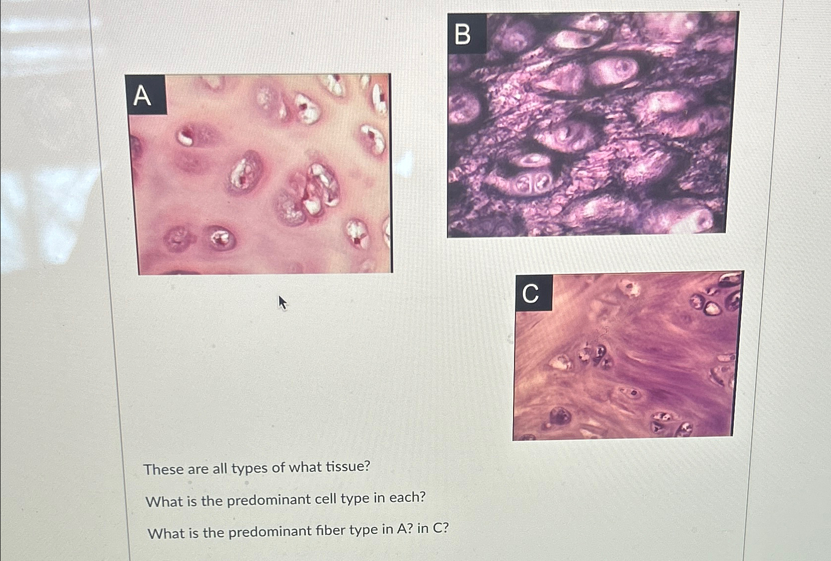 Solved These are all types of what tissue?What is the | Chegg.com