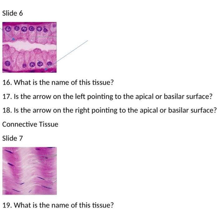 Solved Slide 6 16. What is the name of this tissue? 17. Is | Chegg.com
