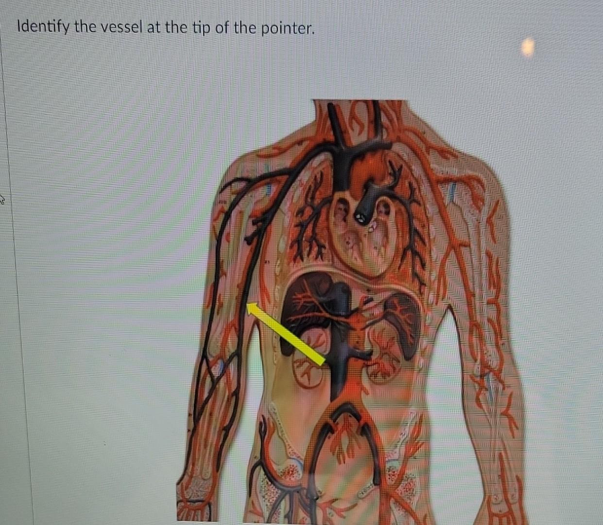 Solved Identify the vessel at the tip of the | Chegg.com