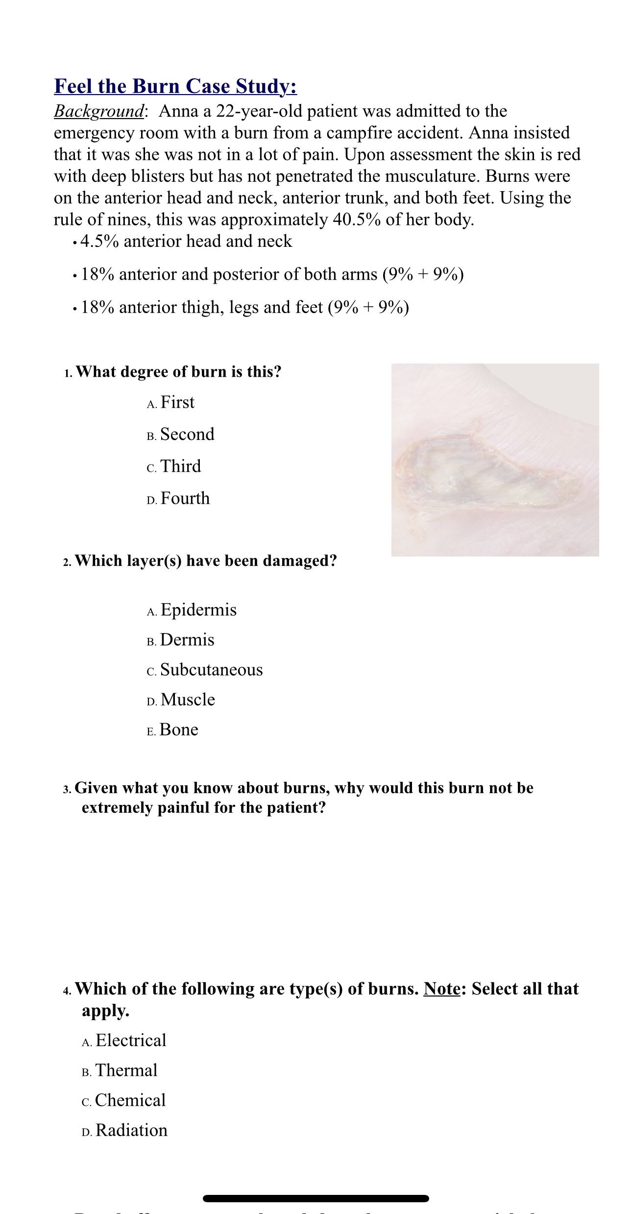 Solved Feel the Burn Case Study:Background: Anna a | Chegg.com