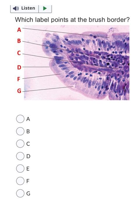 Solved Which label points at the brush border? What is the | Chegg.com