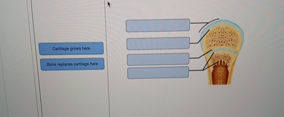Solved Cartilage grows here=Bone replaces cartiage here | Chegg.com