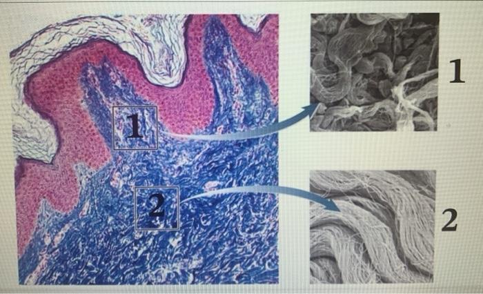 Solved 1 2 How does the structure of the reticular dermis | Chegg.com