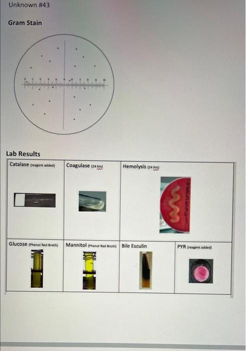 Unknown #43 Gram Stain Lab Results Catalase reagent | Chegg.com