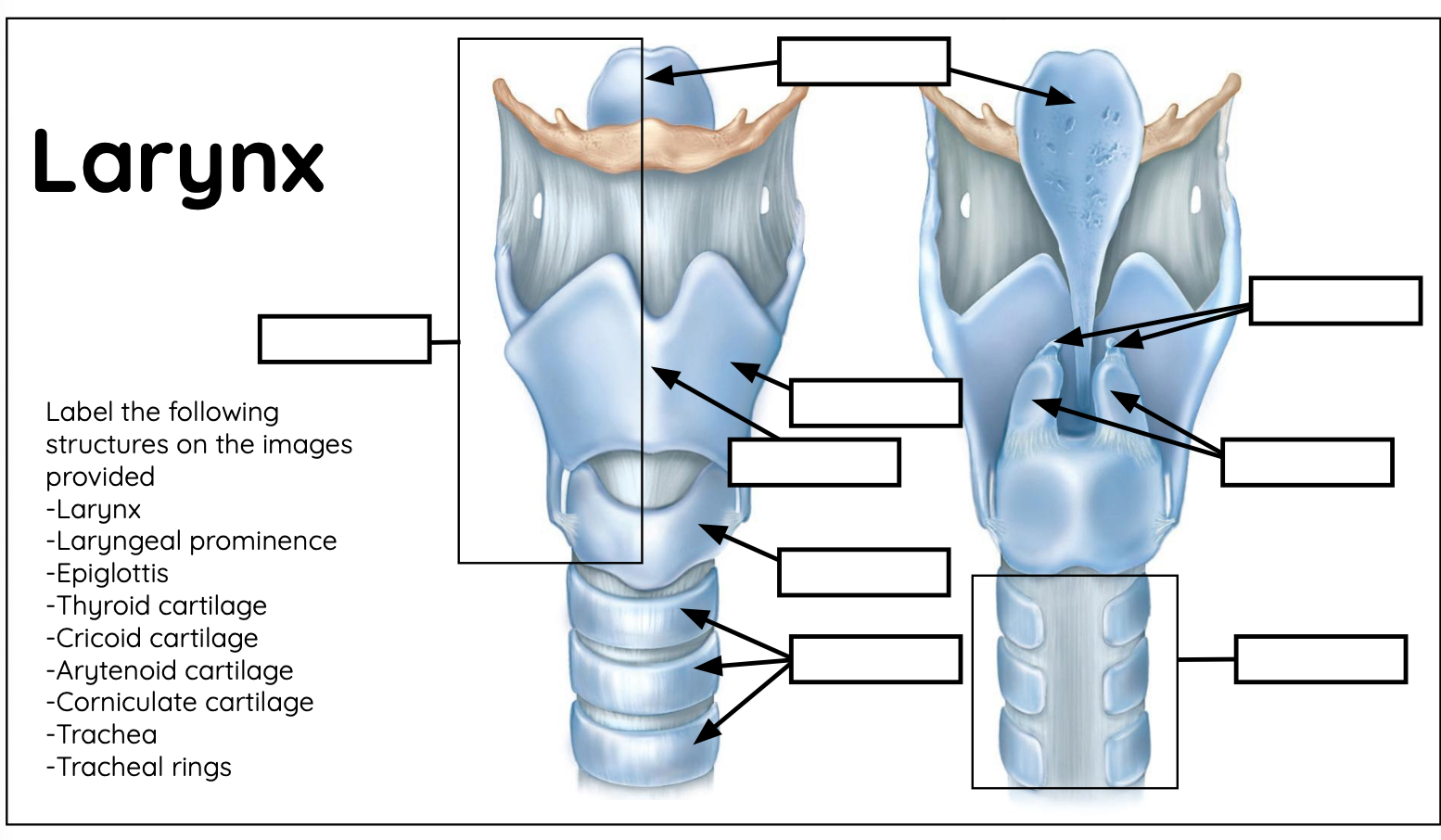 Solved LarynxLabel the following structures on the images | Chegg.com