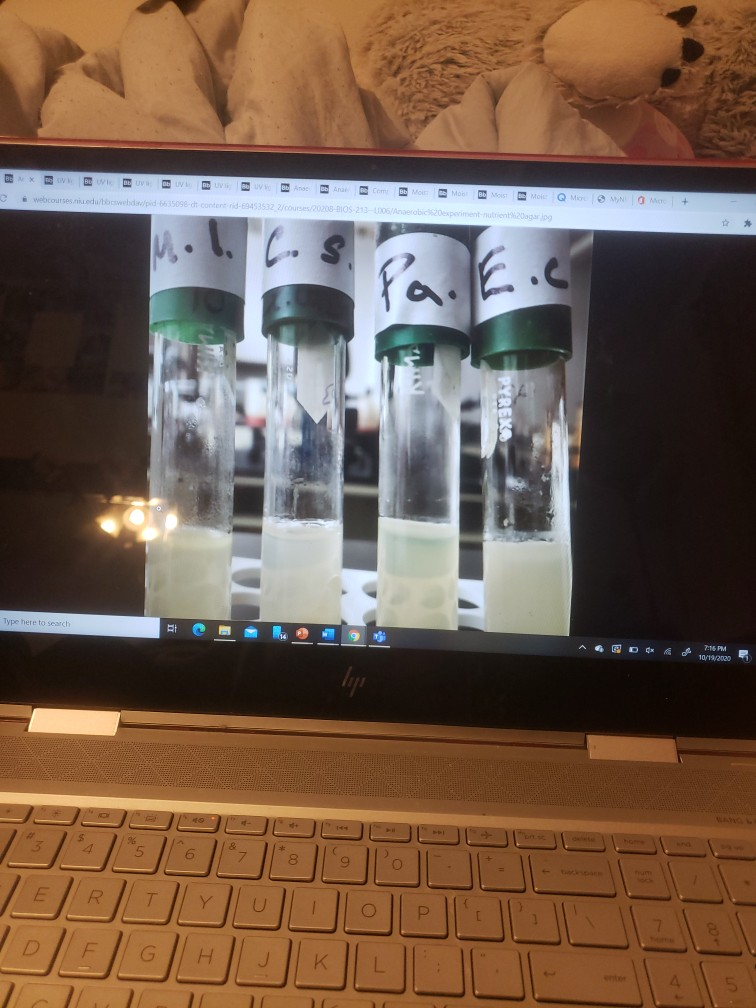 Solved RESULTS 1. In the space below draw the four agar deep | Chegg.com