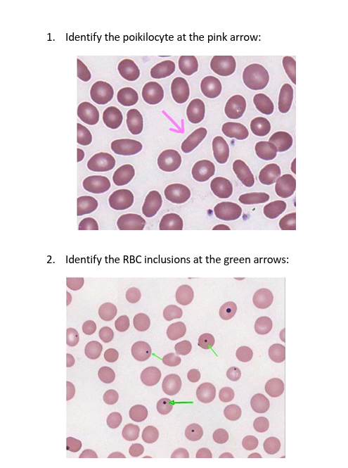 Solved 1. Identify the poikilocyte at the pink arrow:2. | Chegg.com Solved 1. Identify the poikilocyte at the pink arrow:2. | Chegg.com