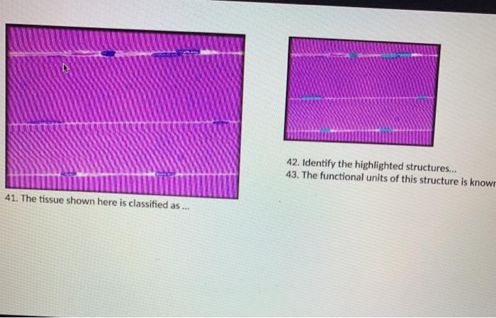 Solved 42. Identify the highlighted structures... 43. The | Chegg.com