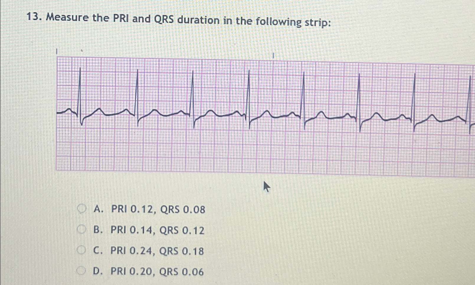 Solved Measure the PRI and QRS duration in the following | Chegg.com