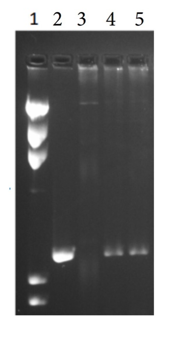 Solved I’ve isolated a plasmid from E. coli puC19 and ran a | Chegg.com