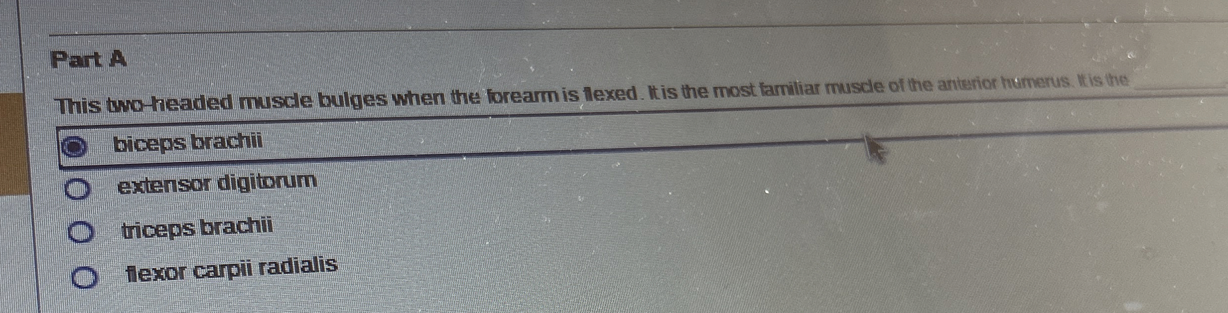 High Quality SOLUTION Part AThis two-headed muscle bulges when the ...