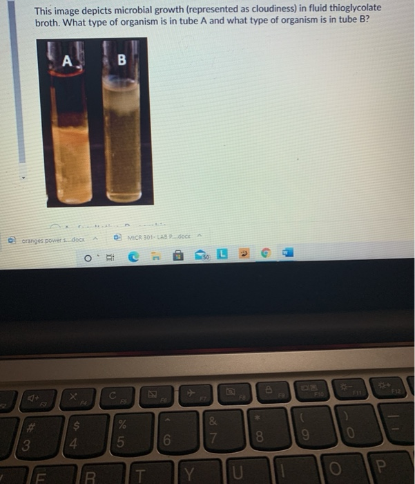 Solved After inoculating and incubating an unknown microbe | Chegg.com