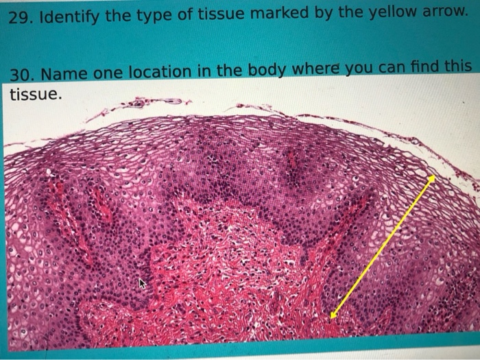 Solved 21. Identify the type of tissue shown below. 22. Name | Chegg.com