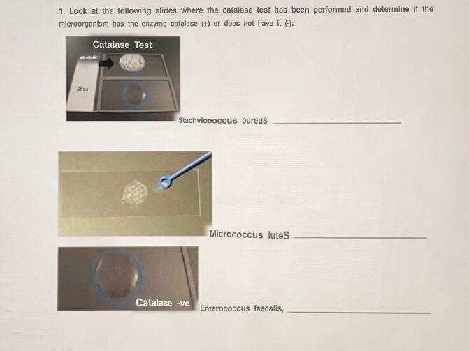 Staphylococcus Aureus Catalase Test