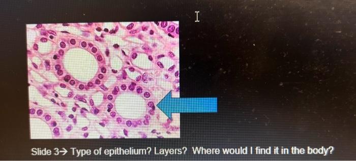 Solved Slide 3→ Type of epithelium? Layers? Where would I | Chegg.com