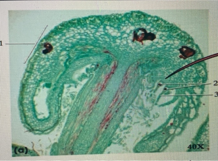 Solved the archegonial receptacle/ archegonial head (female) | Chegg.com