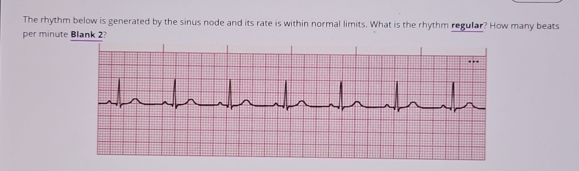 Solved The rhythm below is generated by the sinus node and | Chegg.com