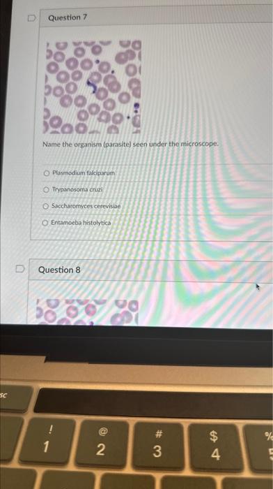 Solved Name the organism (parasite) seen under the | Chegg.com