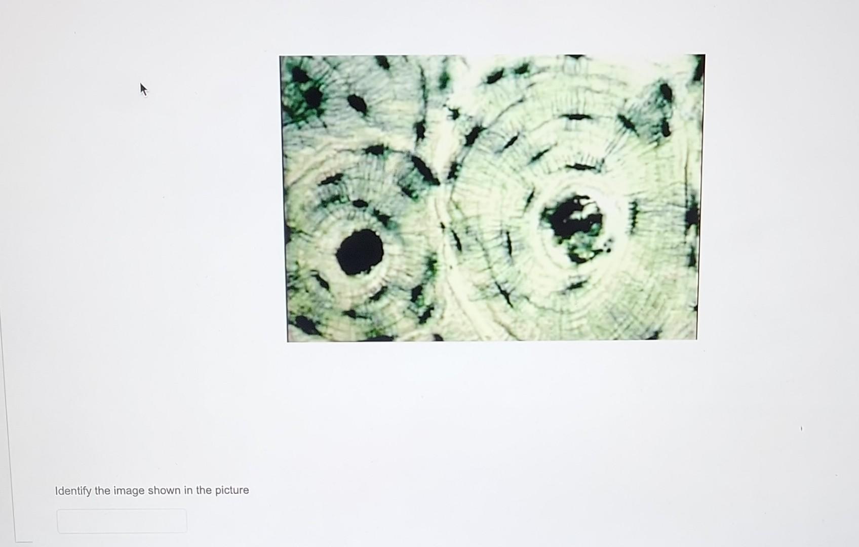 Solved Identify the image shown in the picture | Chegg.com