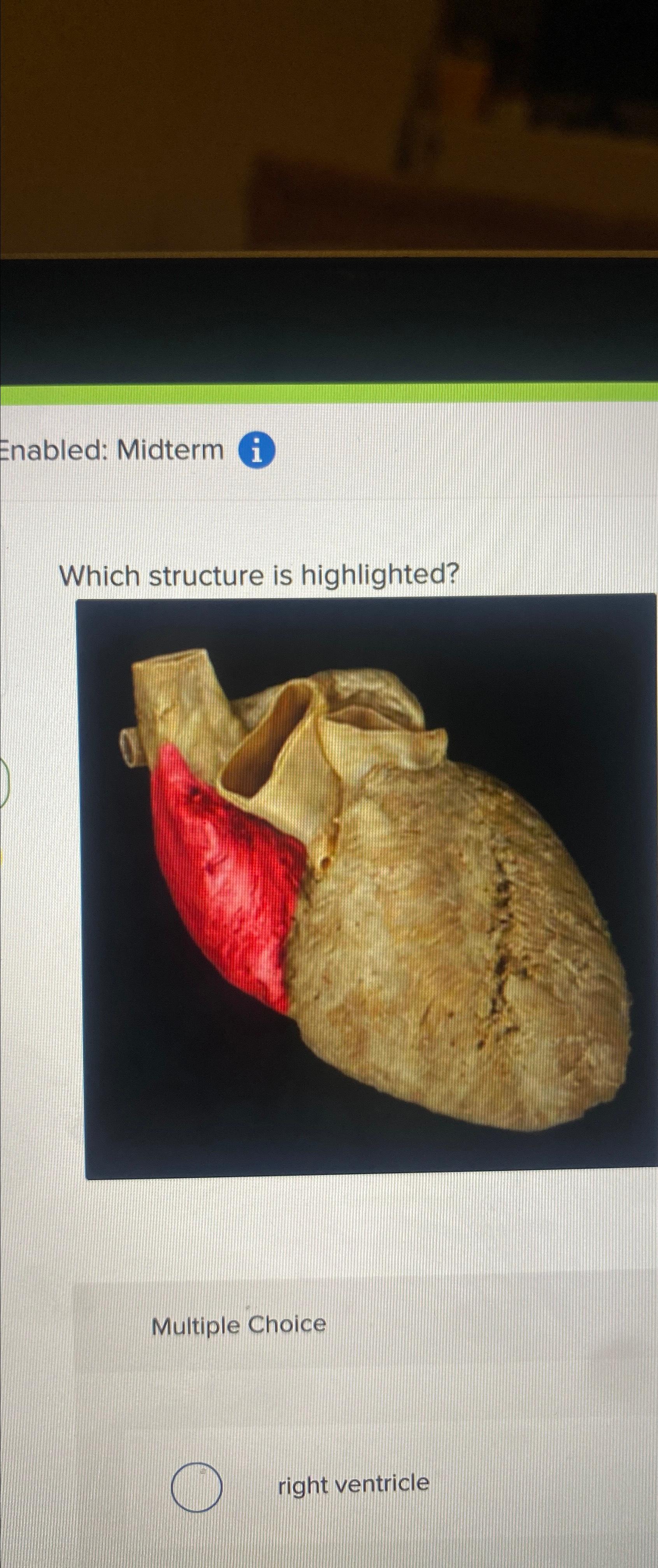 Solved Which structure is highlighted?Multiple Choiceright | Chegg.com