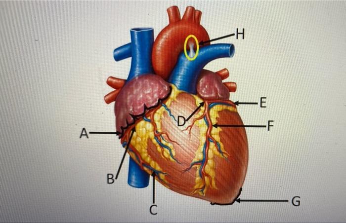 Solved label the blood vessels | Chegg.com