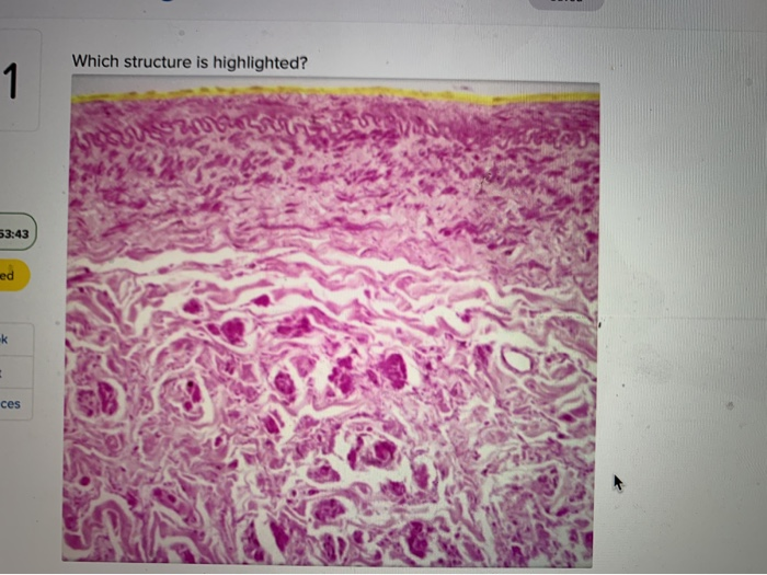 Solved Which structure is highlighted? 53:43 ces orksheet | Chegg.com