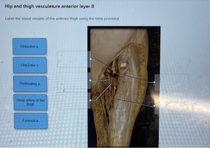 Solved Hip and thigh vasculature anterior layer 8 Label the | Chegg.com