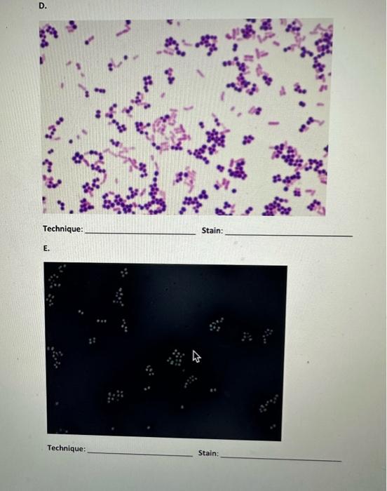 Solved 12. Identify simple stain, negative stain, gram | Chegg.com