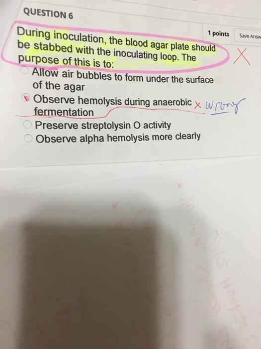 Solved Save Answe QUESTION 6 1 points During inoculation, | Chegg.com