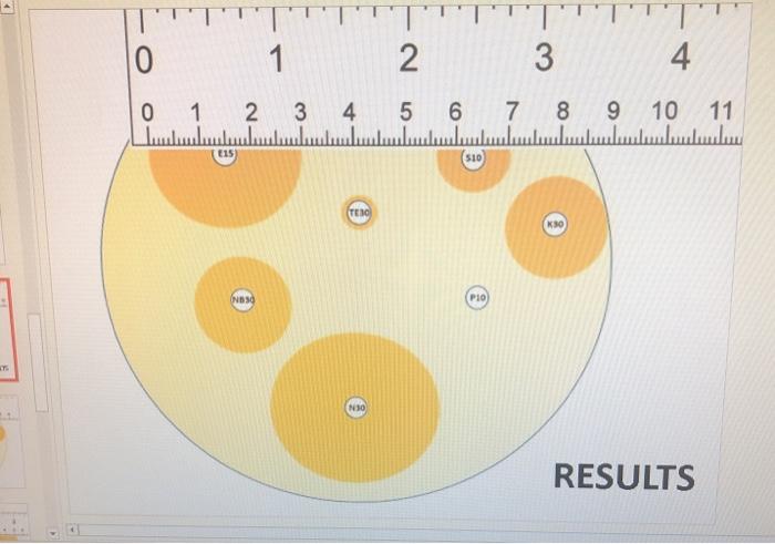 Solved Results: Table 1. Zone Size Interpretation Chart and | Chegg.com