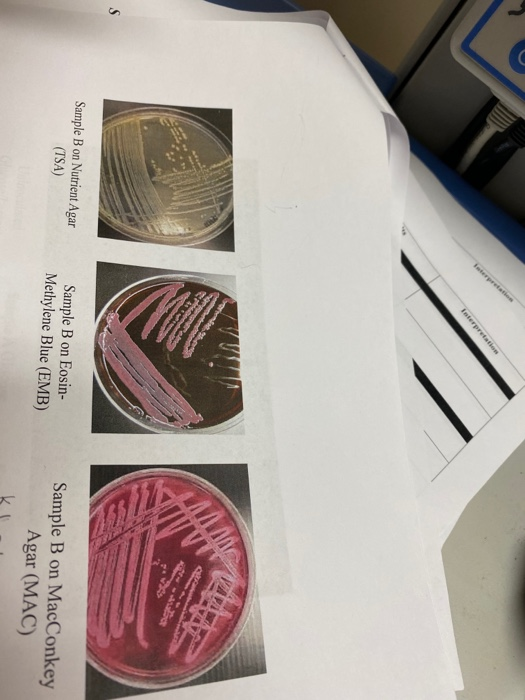 Solved Sample B Wet Mount Sample B Gram Stain ena Sample B | Chegg.com