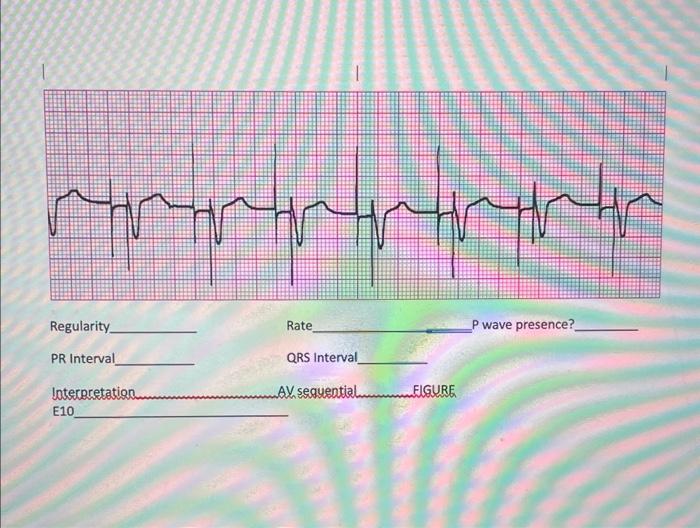 Solved Regularity Rate PR Interval QRS Interval | Chegg.com