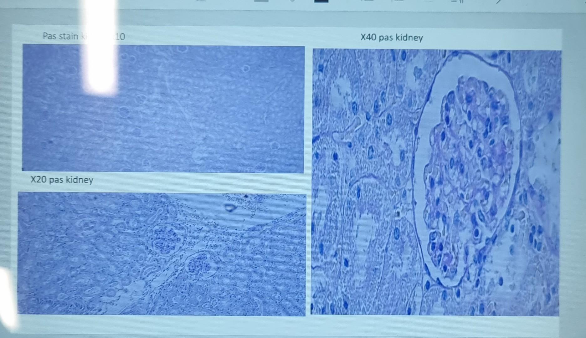Solved the above slide is a histology slide from a bone. | Chegg.com