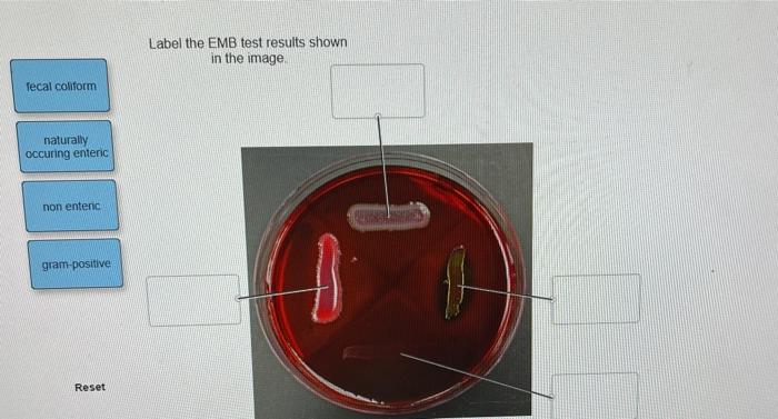 Solved Label the EMB test results shown in the image fecal | Chegg.com