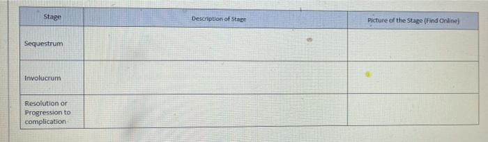 Solved Stage Description of Stage Picture of the Stage (Find | Chegg.com