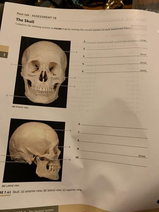 Solved Post-lab Assessments CHECK WHAT YOU LEARNED Post-lab | Chegg.com