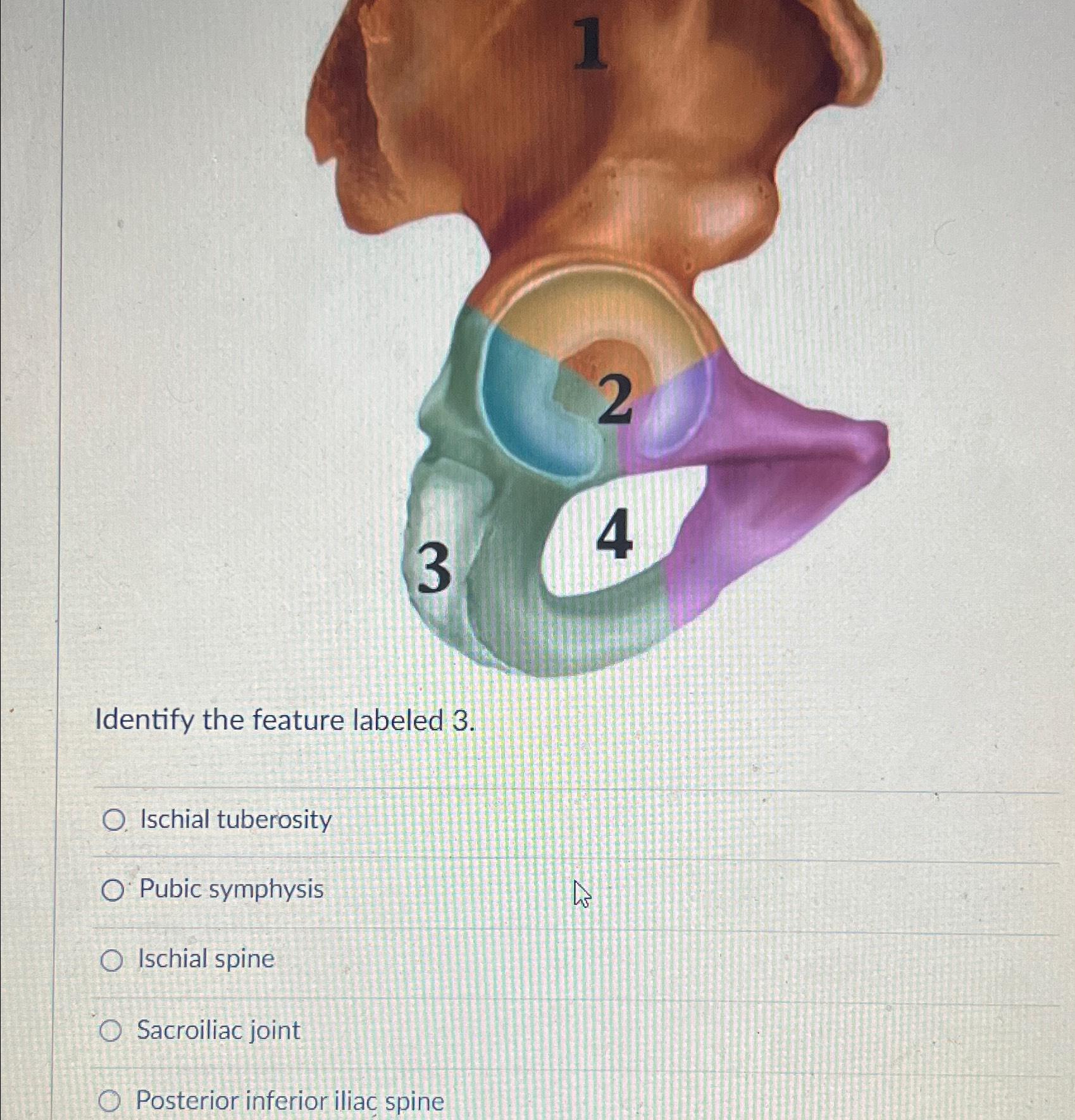 Solved Identify the feature labeled 3.Ischial | Chegg.com