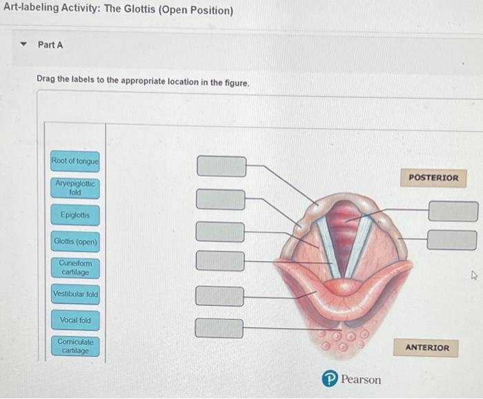 Solved Art-labeling Activity: The Glottis (Open Position) | Chegg.com